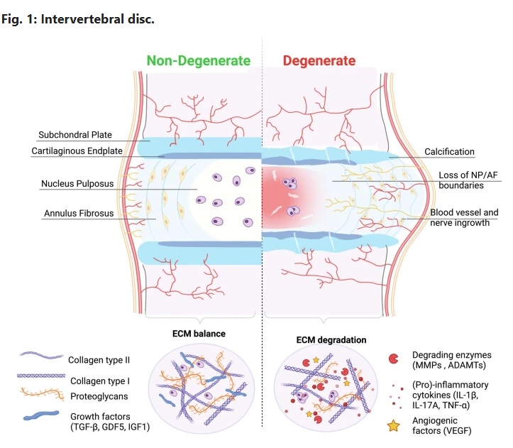 Nucleus pulposus cell network modelling in the intervertebral disc – Disc4All